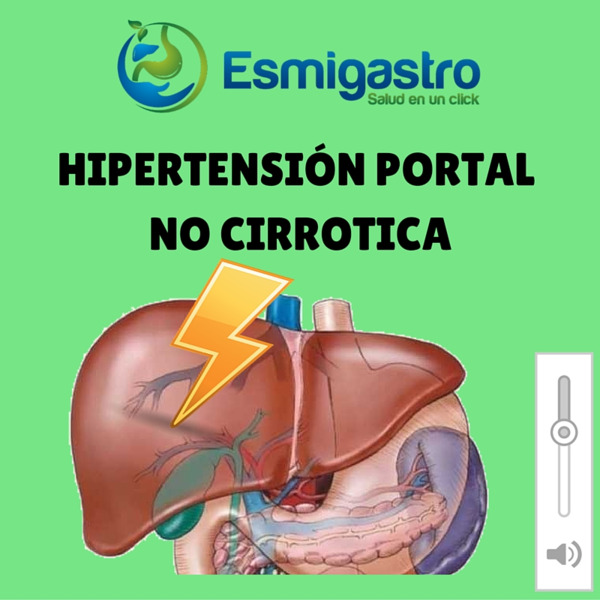 Anatomía De Las Varices Esofágicas